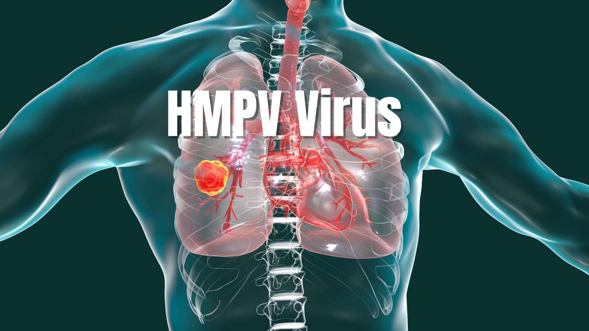 Understanding HMPV Virus: Causes, Symptoms and Prevention ...