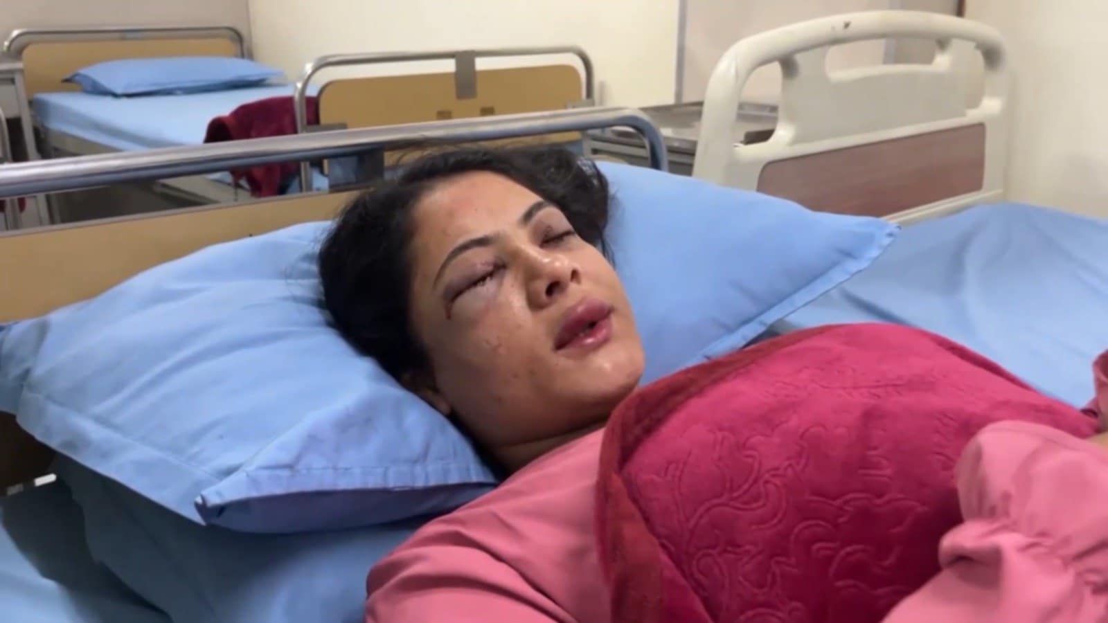Journalist Karki Sustains Eye Injuries While Covering Teachers Protest